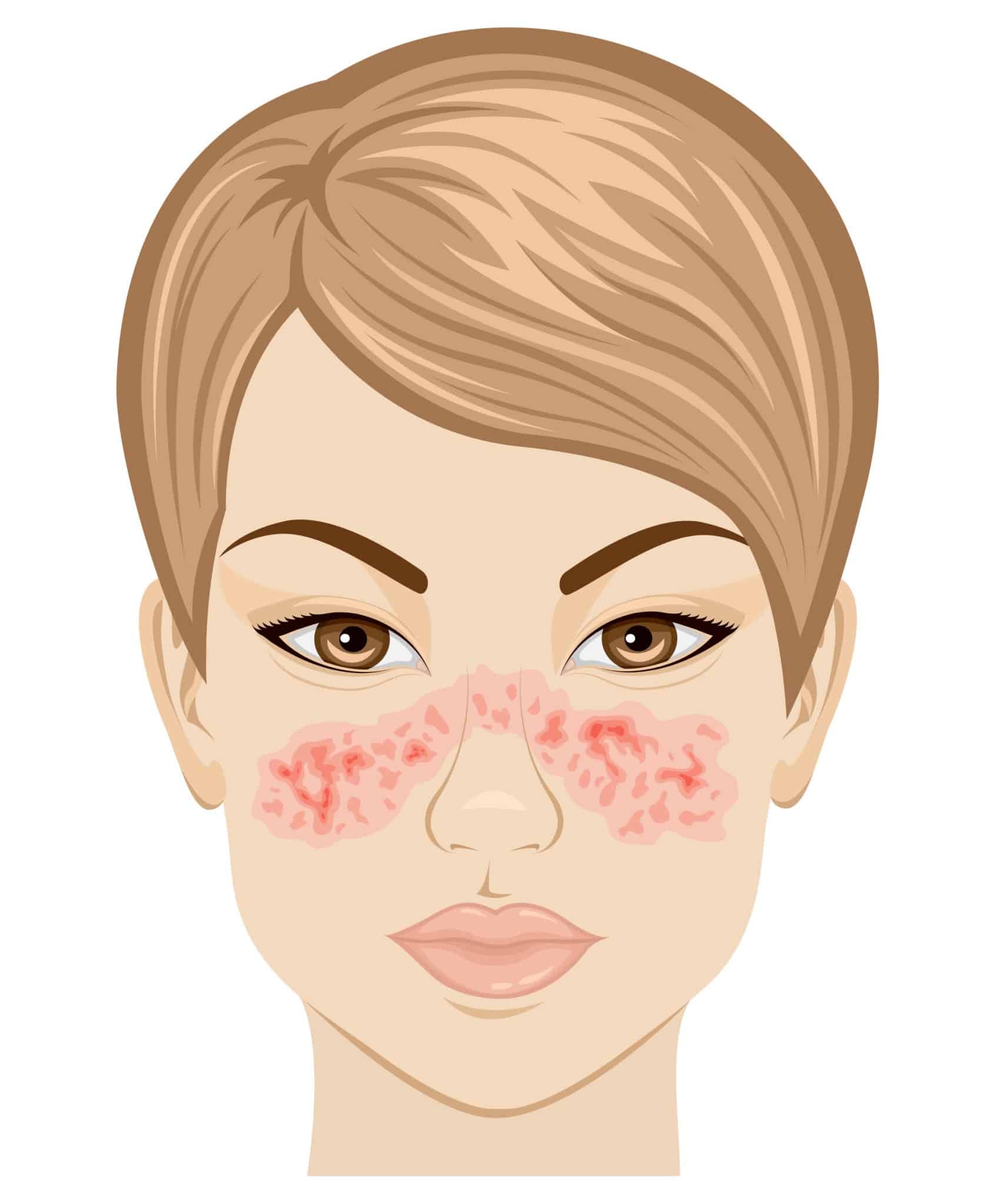 Traumatisme de la vessie - Dr Learnycare