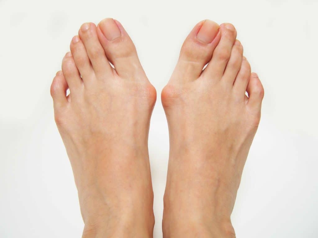 Pied diabétique (ou mal perforant plantaire) - Dr Learnycare