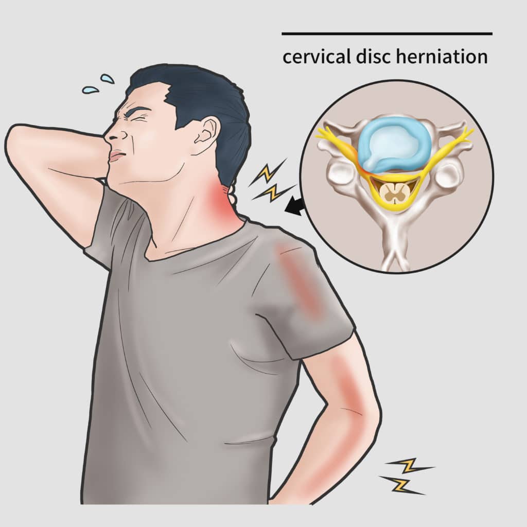 Traumatisme de la vessie - Dr Learnycare
