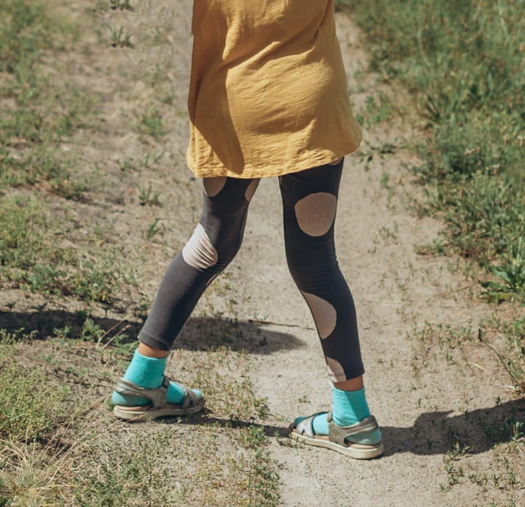 Angiome étoilé (stellaire) - Dr Learnycare