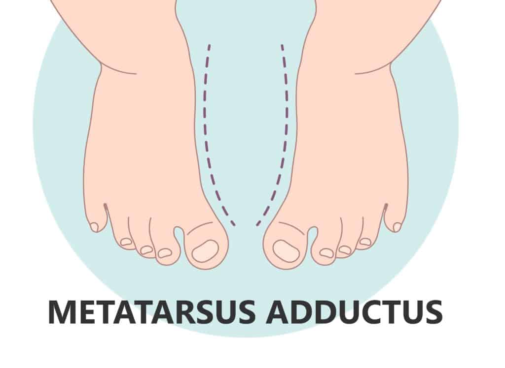 Douleurs après zona - Dr Learnycare