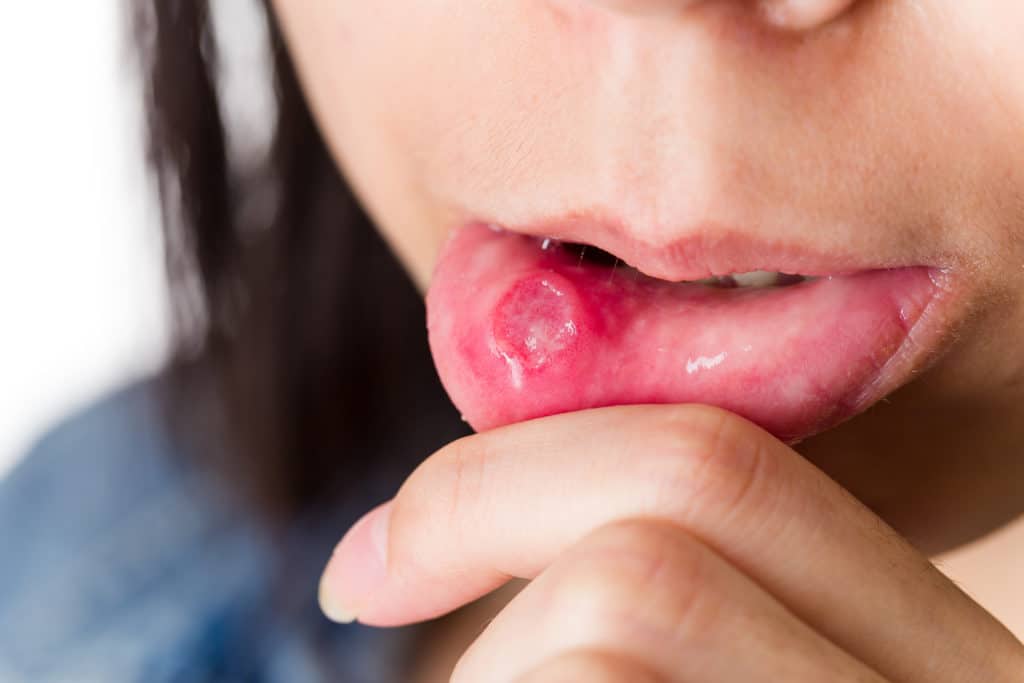Pied diabétique (ou mal perforant plantaire) - Dr Learnycare