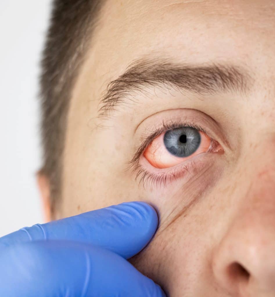 Maladie de Baastrup - Dr Learnycare