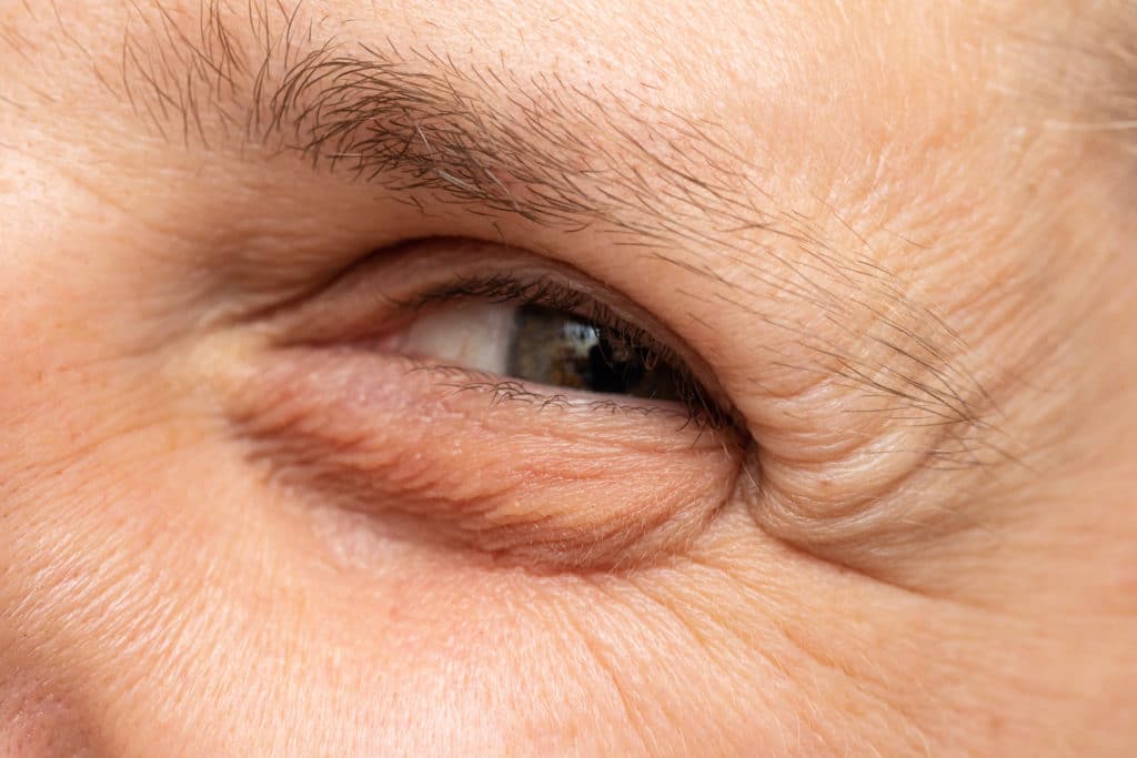 Syndrome de Pellegrini Stieda - Dr Learnycare