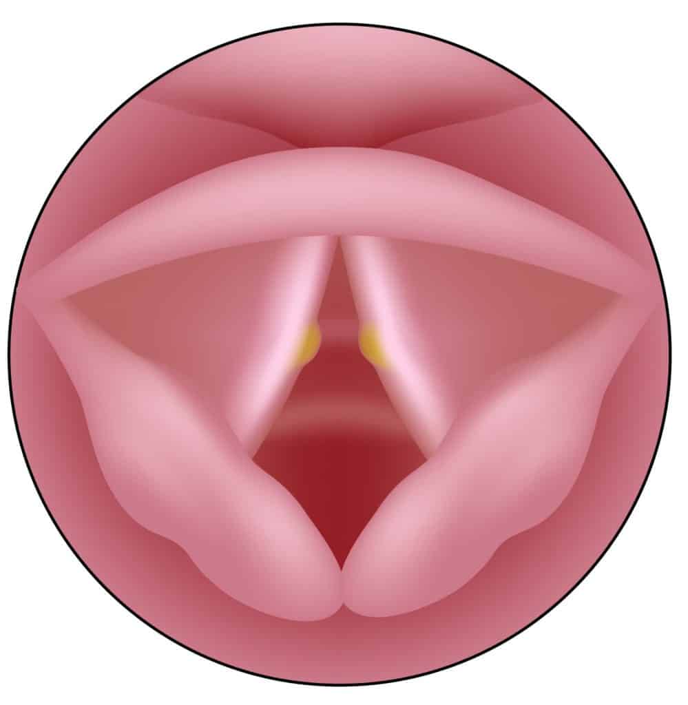 Néphroangiosclérose - Dr Learnycare