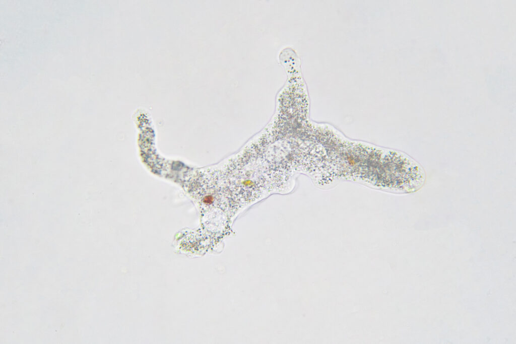 Prurigo strophulus - Dr Learnycare